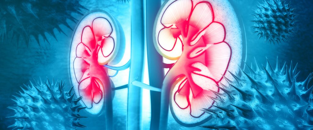 A Discovery That May Halt Kidney Disease Progression