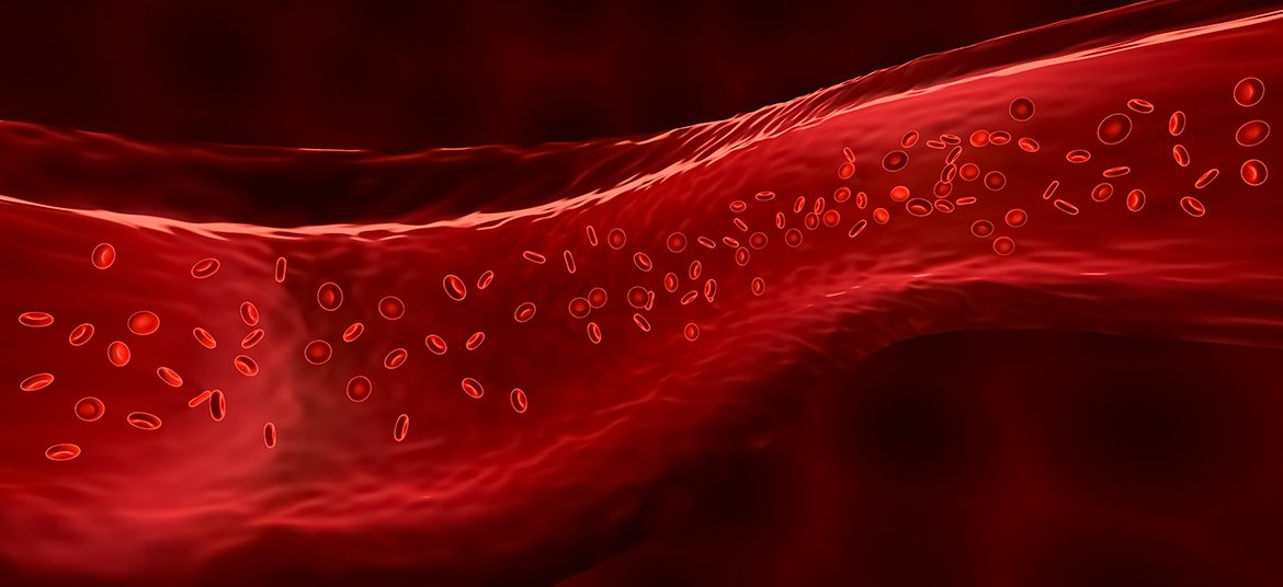 Humacyte Sends First Shipment of Human Acellular Vessels to Ukraine as ...