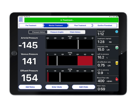 NxStage VersiHD with GuideMe Software