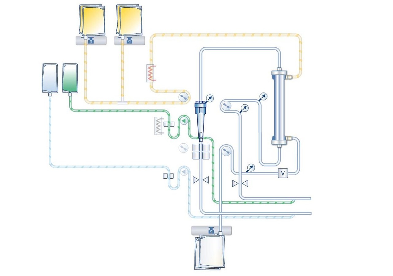 multiFiltratePRO | Fresenius Medical Care