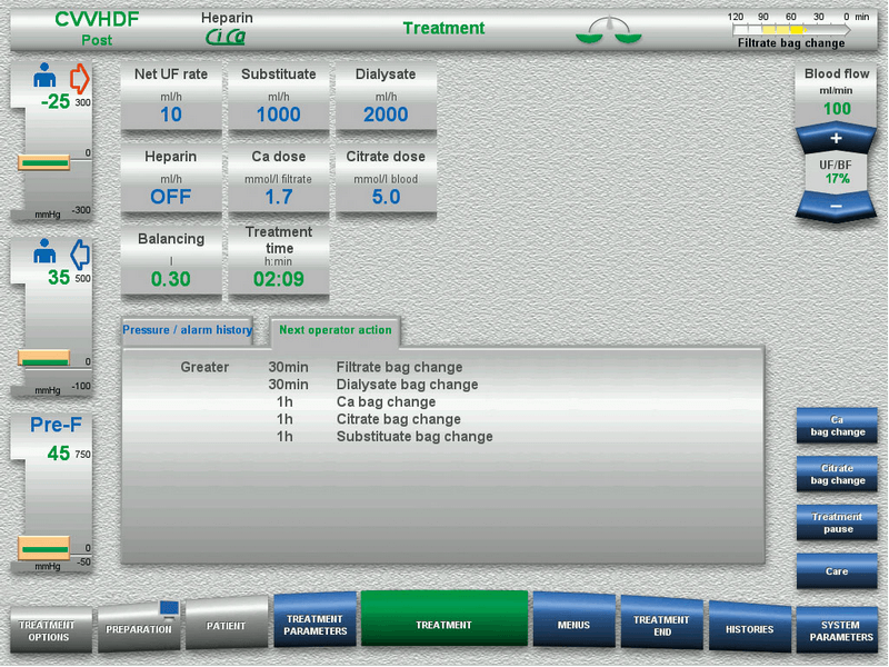 multiFiltratePRO | Fresenius Medical Care