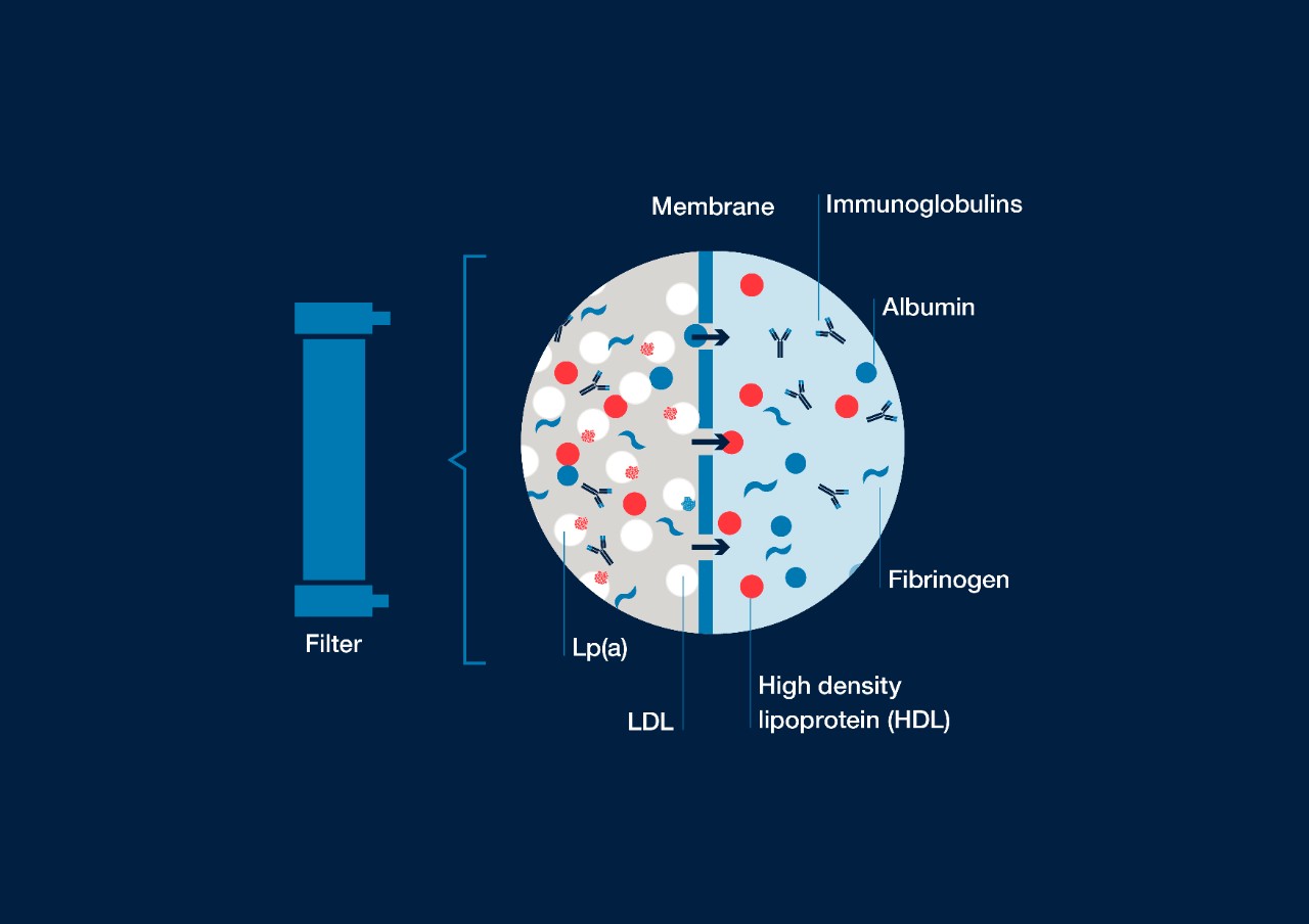 Lipoprotein-Apherese | Fresenius Medical Care