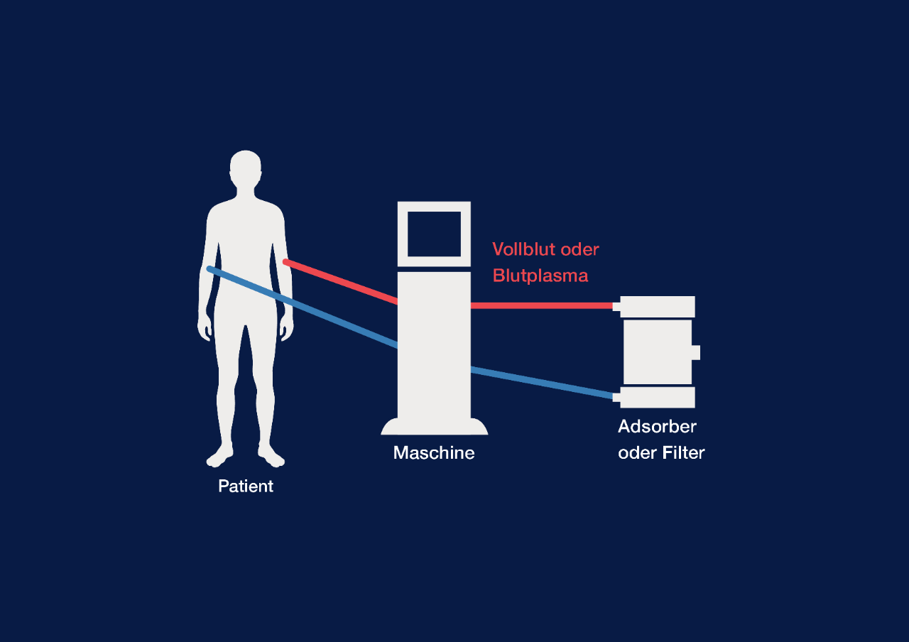 Therapeutische Apherese | Fresenius Medical Care