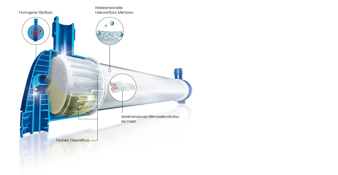 FX CorDiax- Dialysatoren | Fresenius Medical Care