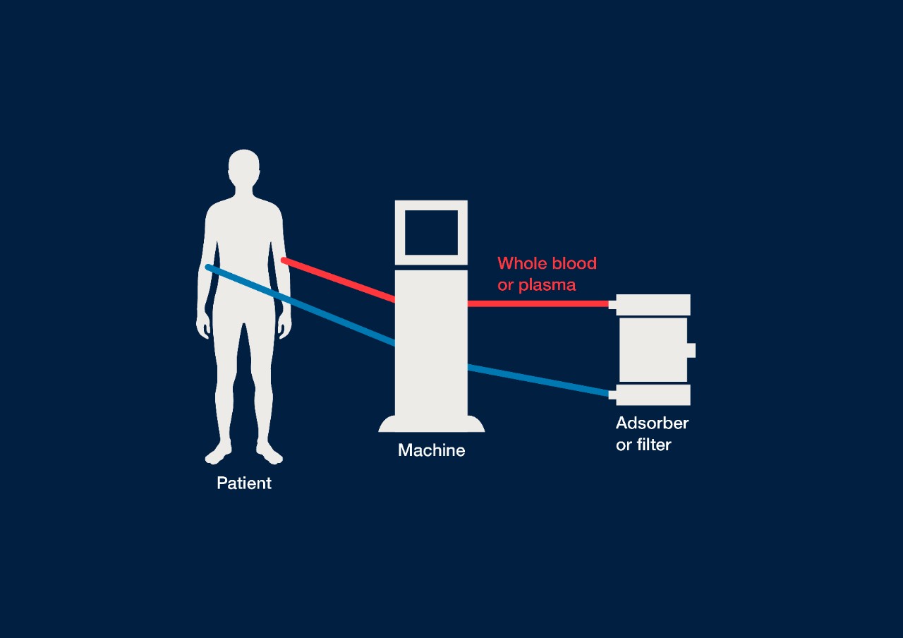 Therapeutic apheresis | Fresenius Medical Care