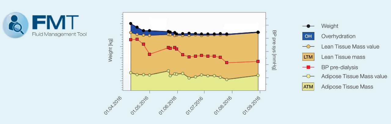 Advanced Fluid Management overview | Fresenius Medical Care