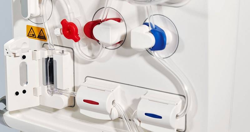 Advanced Fluid Management overview | Fresenius Medical Care