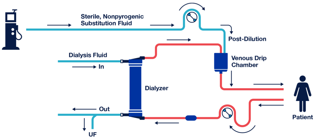 Strategy to Expand HVHDF Worldwide | Fresenius Medical Care