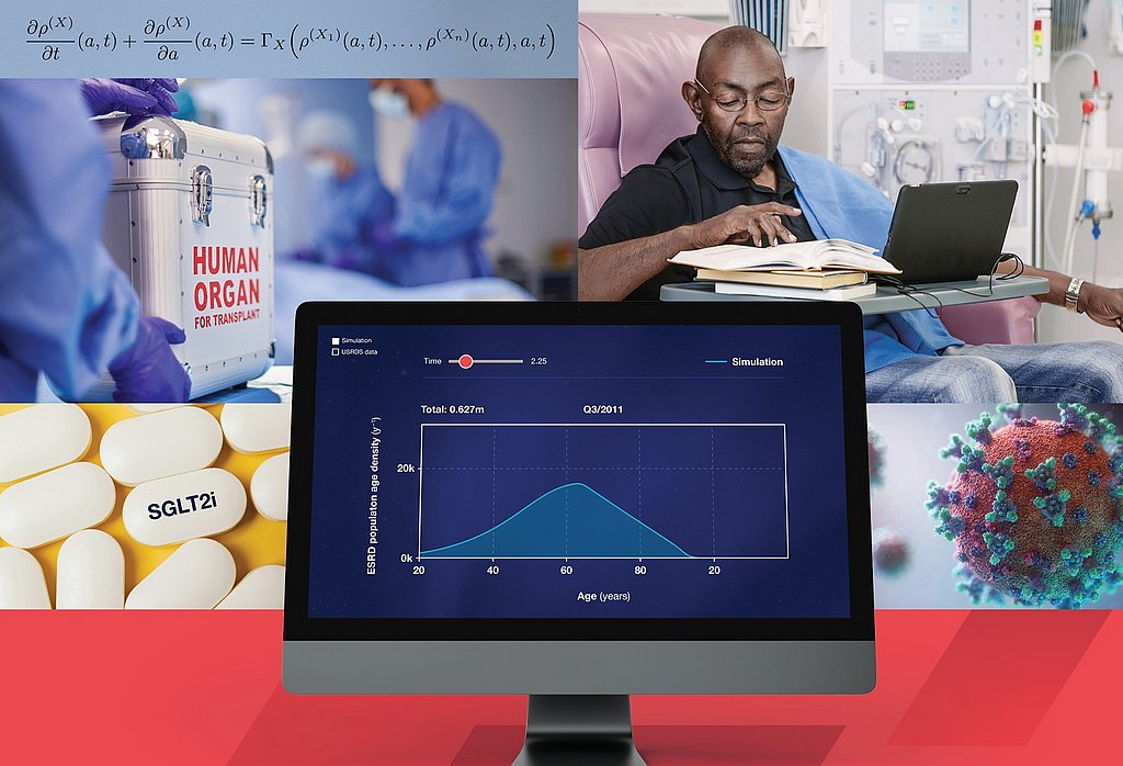 Predicting Population Trends in Kidney Health Using Advanced Mathematical Modeling | Fresenius ...