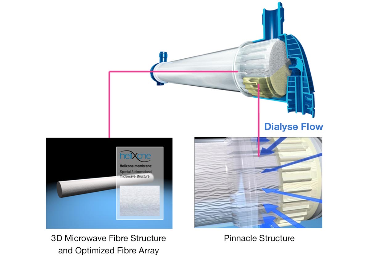 Dializadores FX classix | Fresenius Medical Care