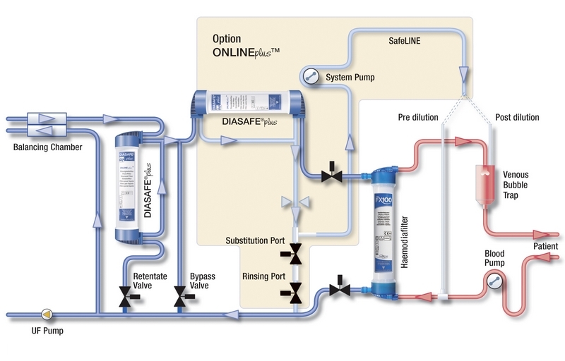 DIASAFEplus dialysis fluid filter | Fresenius Medical Care