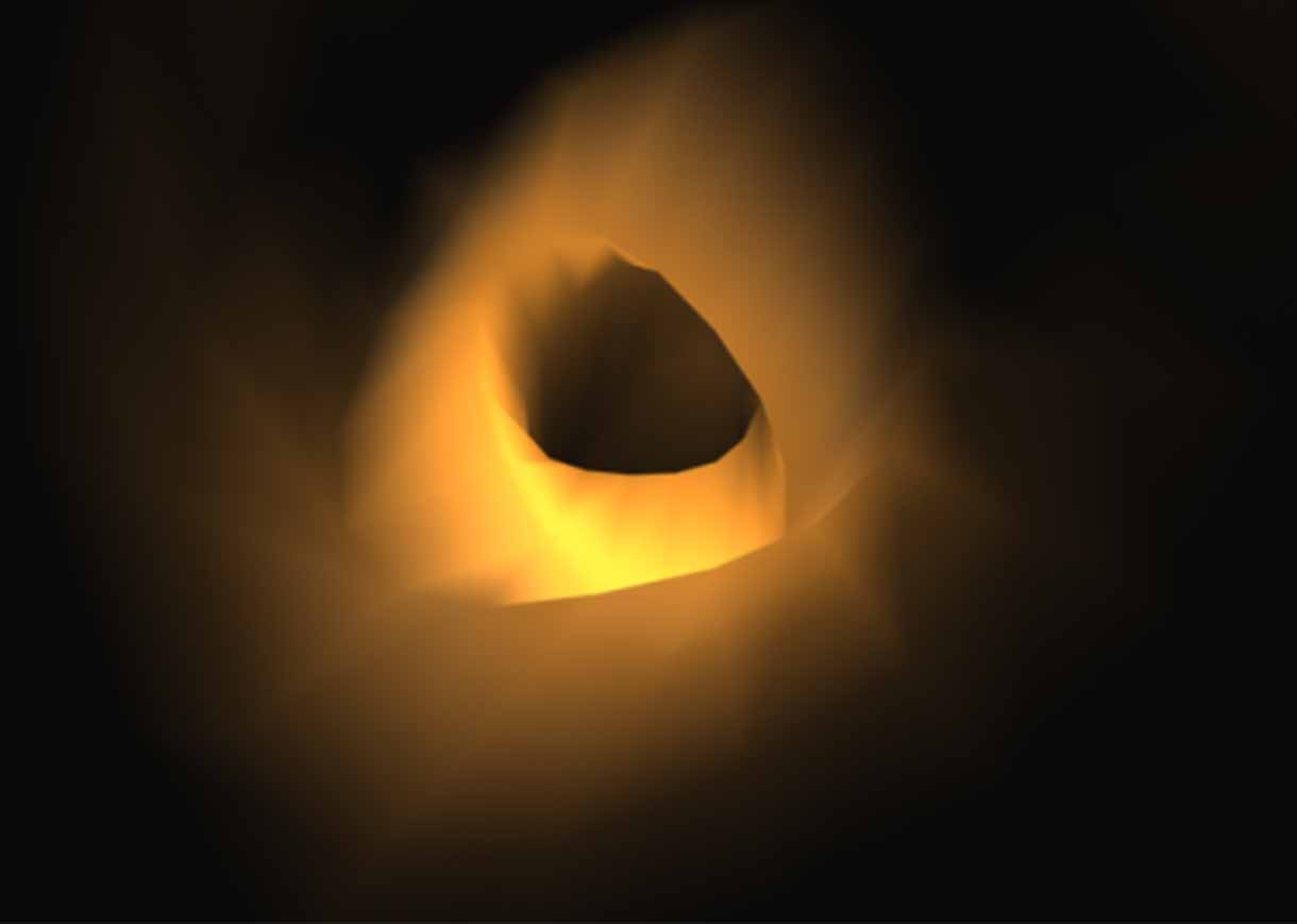 FX high and low-flux dialysers | Fresenius Medical Care