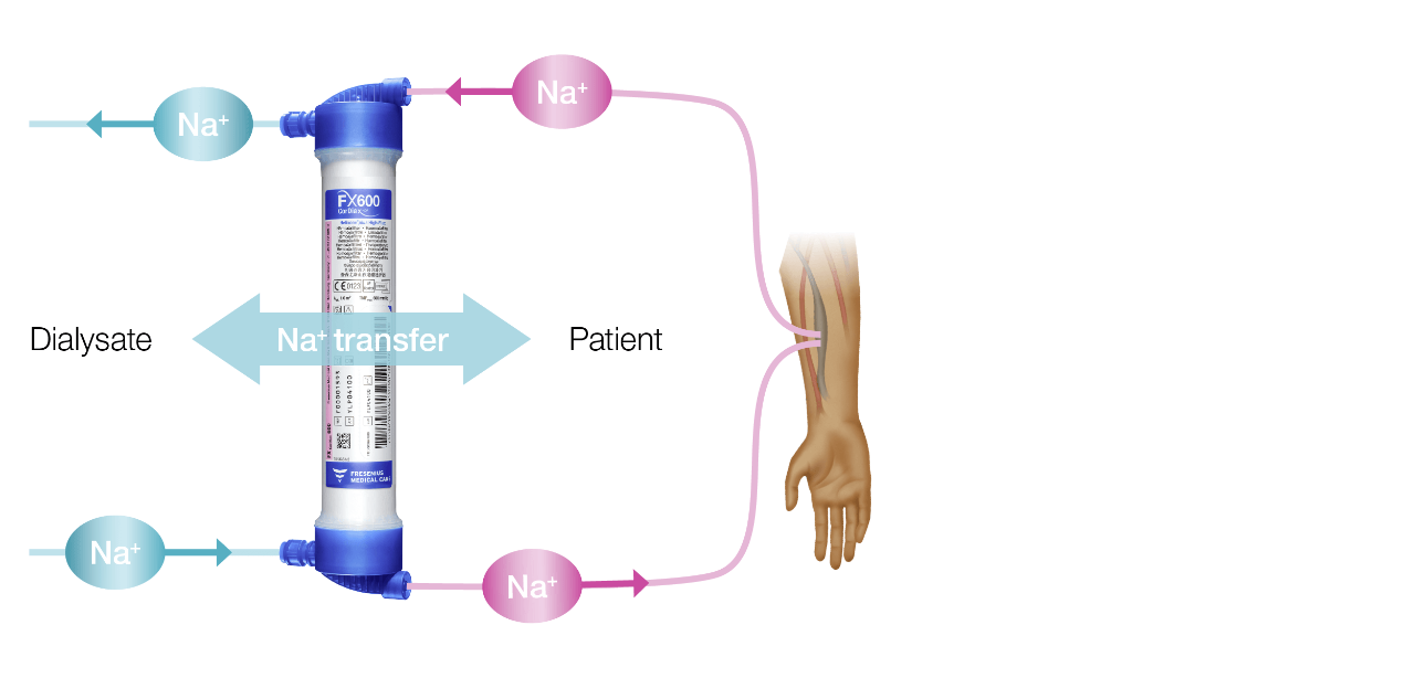 Individualised sodium management | Fresenius Medical Care